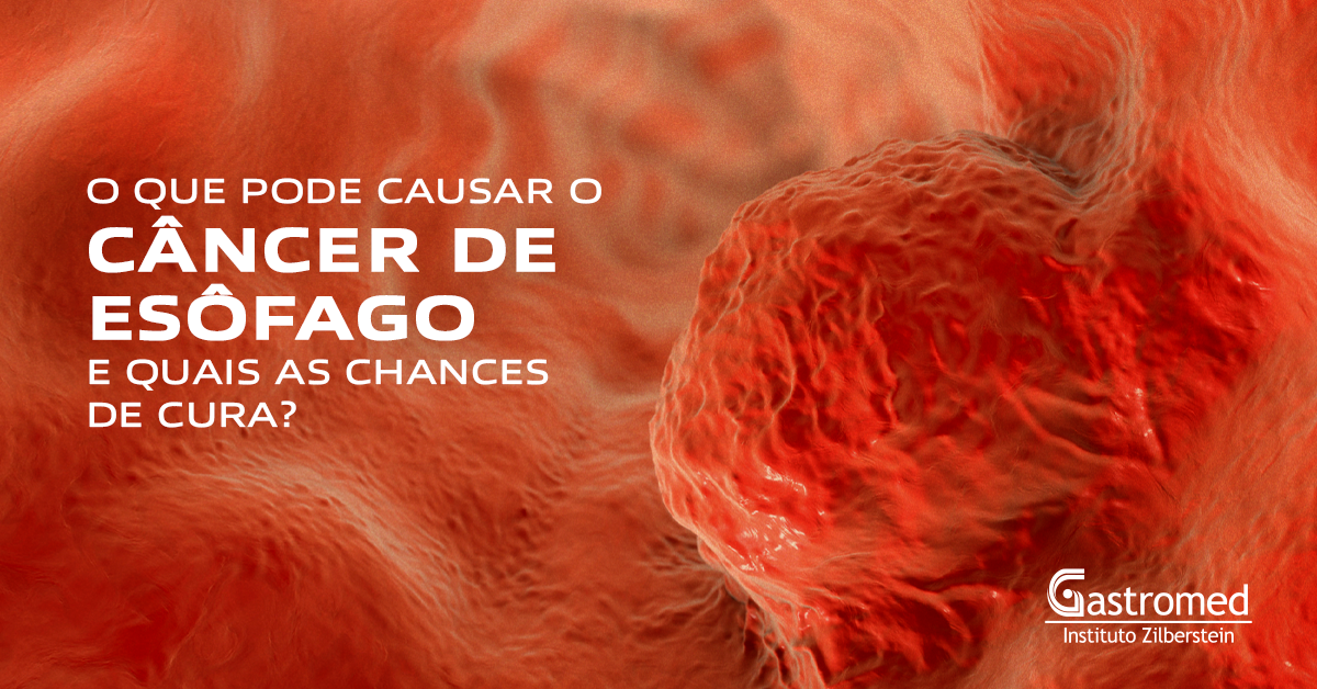 O que pode causar o câncer de esôfago e quais as chances de cura ...
