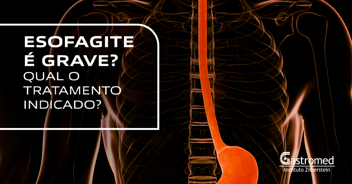 Esofagite é grave? Qual o tratamento indicado? - Gastromed